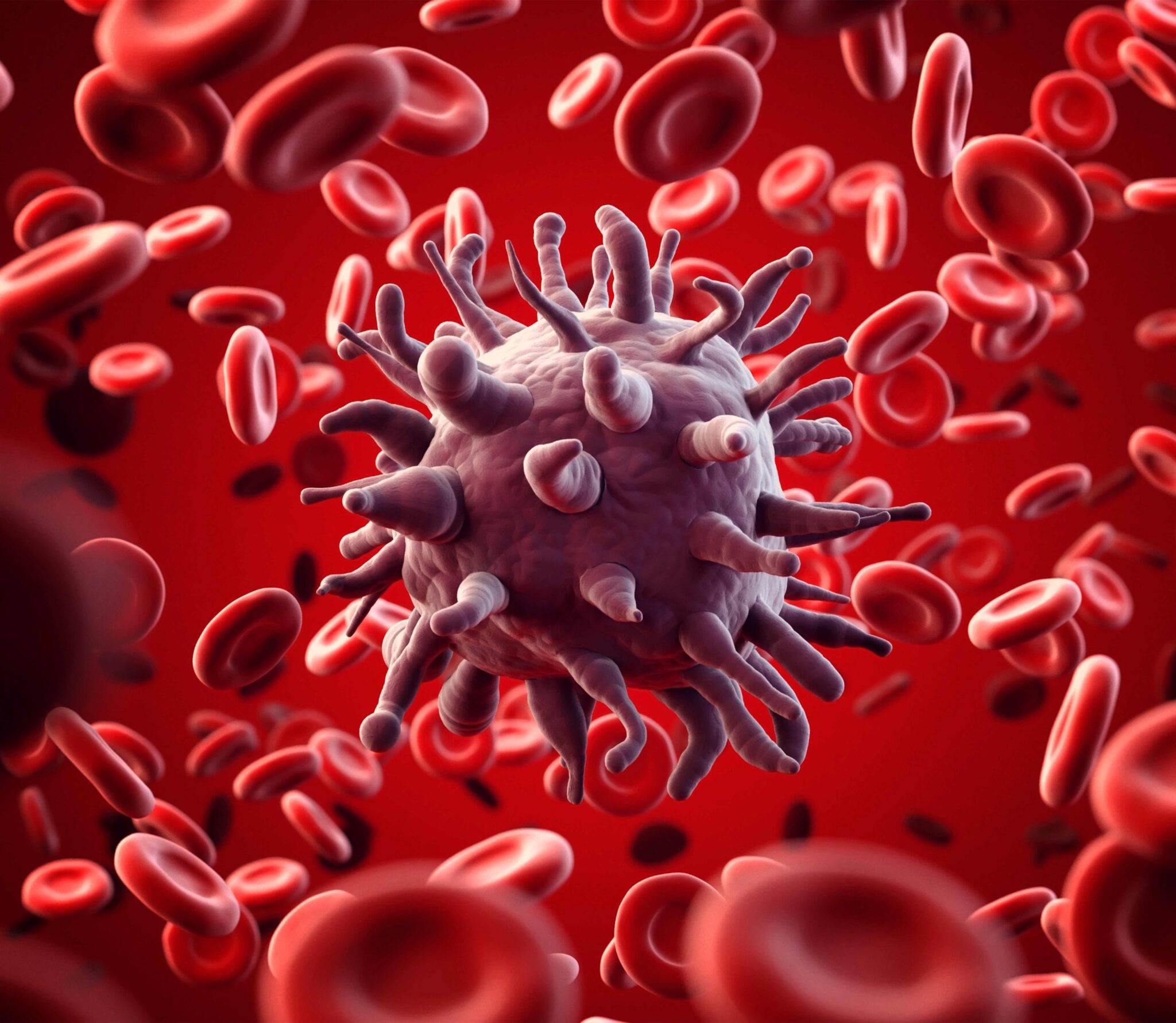 Wat is aplastische anemie? - AAenPNH